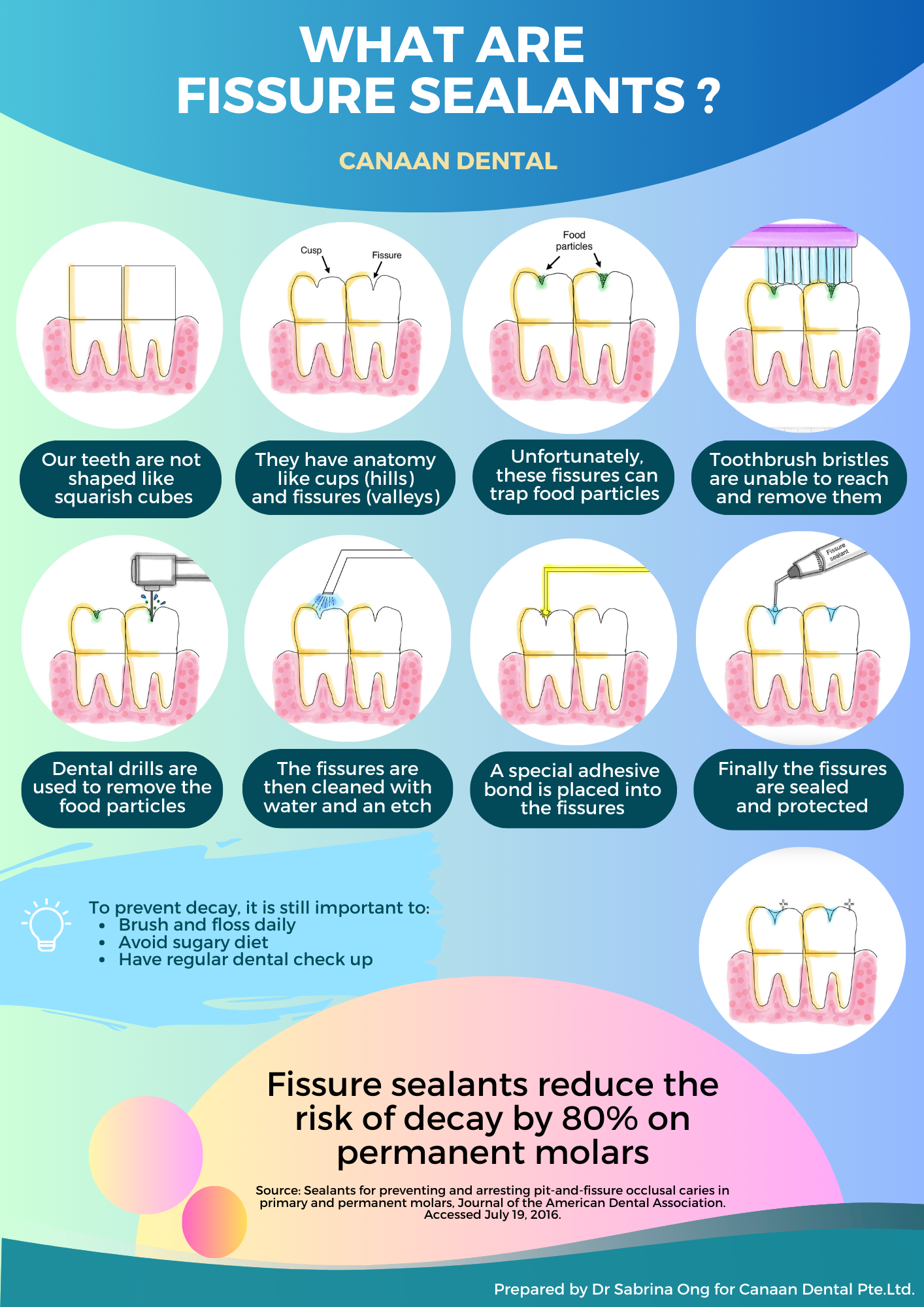 Canaan Dental | What Are Fissure Sealants & How They Protect Your Teeth